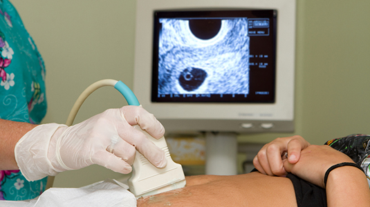 Medical Imaging Erina | Ultrasound