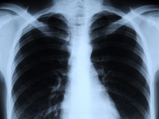 Medical Imaging Erina | X-Ray